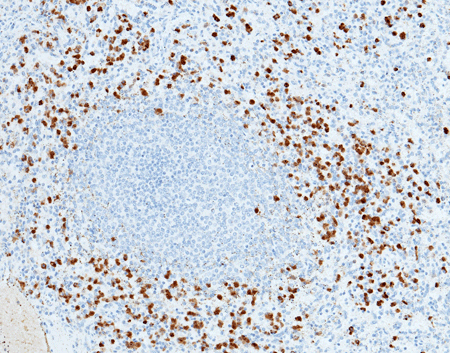 Anti-S100A12 antibody (102823)