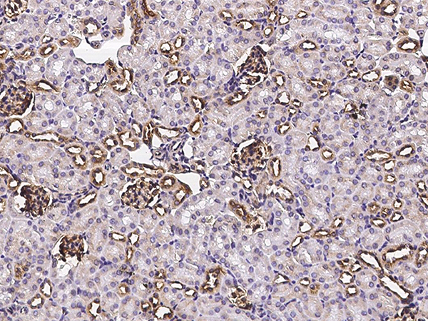 Anti-CD59a / Protectin antibody (100957)