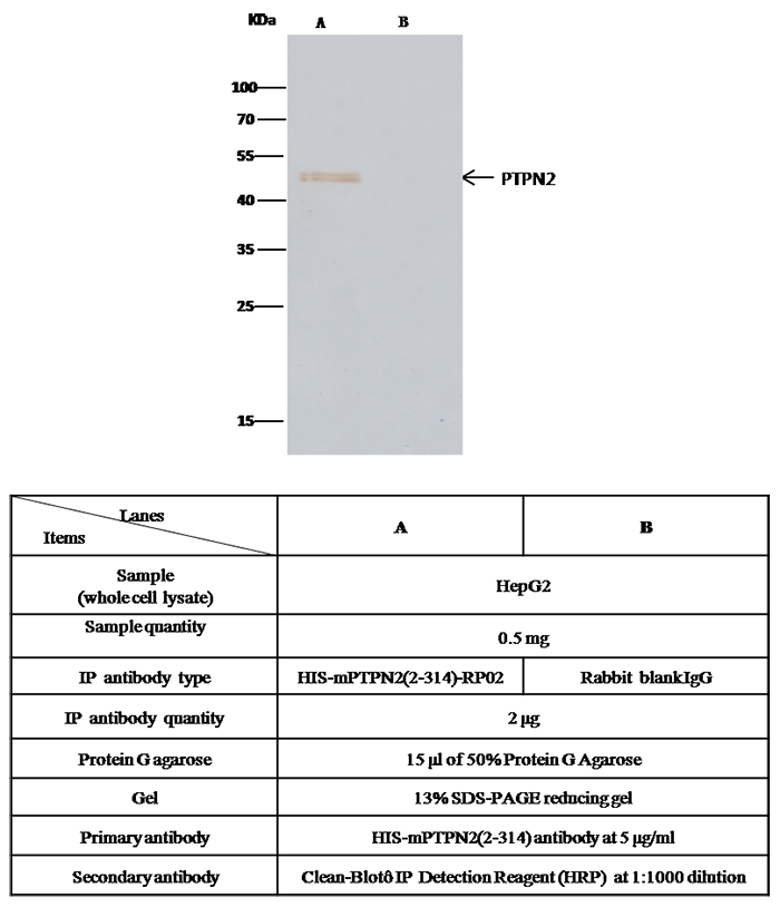 Anti-PTPN2/TC-PTP antibody (105641)