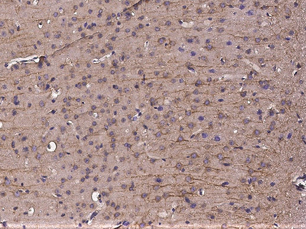 Anti-CD59a / Protectin antibody (100957)
