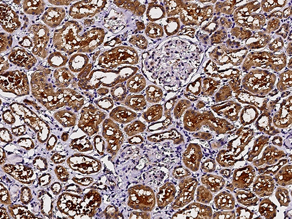 Anti-PMVK / phosphomevalonate kinase antibody (106664)