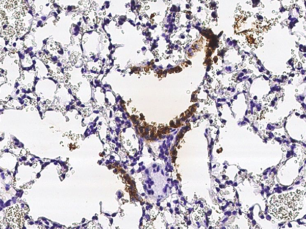 Anti-Uteroglobin/SCGB1A1 antibody (100388)