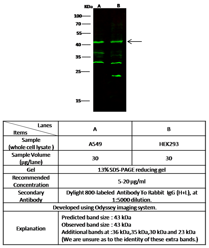 Anti-METAP1 antibody (104969)