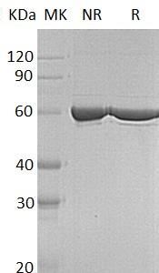 Human PKLR/PK1/PKL recombinant protein